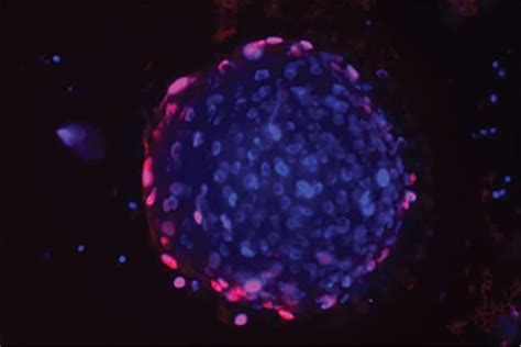 Drug Triggers Immune Cells To Attack Prostate Cancer Bionews Central
