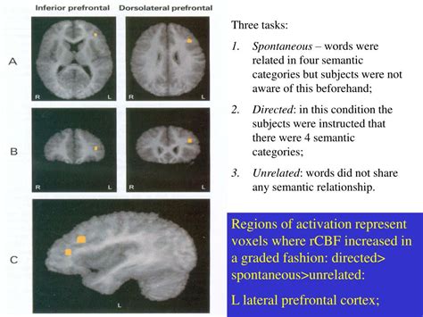 Ppt Distinct Memory Systems Mediating Declarative Emotional And