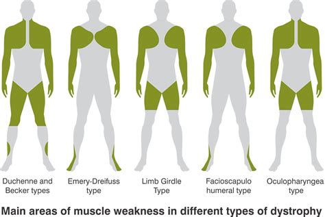 Muscular Dystrophy Cell Therapy