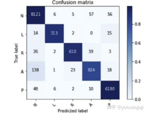 基于深度学习的ecg心信号分类对人体的心电信号进行分类，判断出被测试者心跳是否正常，或患有什么样的心脏疾病，最终实现心电数据的分类。其中包括cnn Lstm Gru等模型对比。 知乎