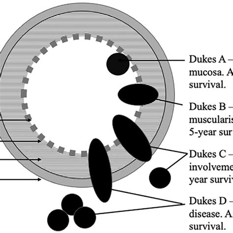 Dukes Classification Summary Survival Approximations From Cancer