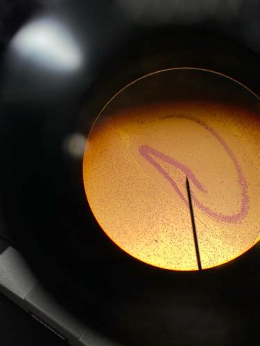 Endocrine Lab Flashcards Quizlet