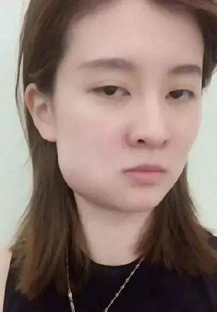 岳云鹏得过的腮腺肿瘤到底是怎样的疾病 搜狐大视野 搜狐新闻