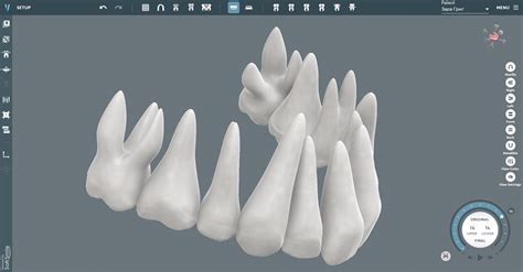 Dental 3d Modeling Software Orthodontic Cad Software