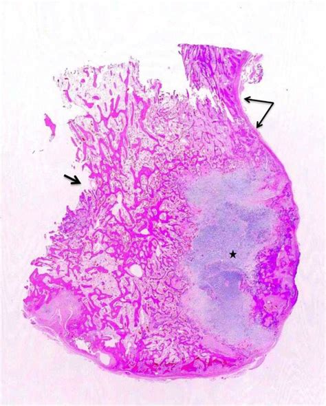 Case 1 On The Gross Specimen Continuity Of The Cortex Long Arrows Download Scientific