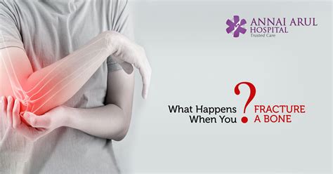 WHAT HAPPENS WHEN YOU FRACTURE A BONE Multispeciality Hospitals In Chennai