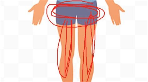 屁股疼、腿疼、腿麻，是腰椎间盘突出了？ 哔哩哔哩