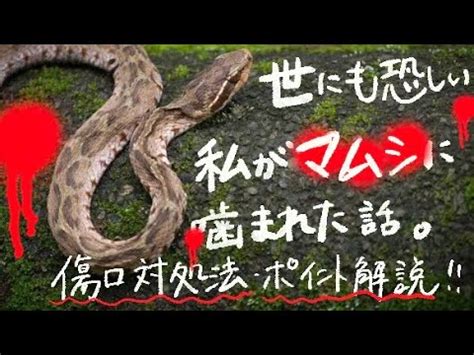 マムシに噛まれたまむしで入院咬み傷の処置法注意点解説します実話ですマムシ酒にして飲んでやりたい YouTube