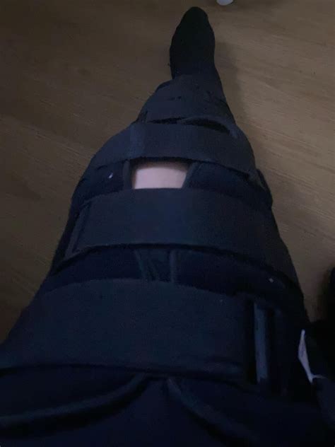 Dislocated My Knee On Monday This Is The Day After R Injuries