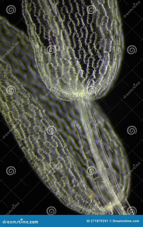 Microscopic View Of Peat Moss Sphagnum Detail Stock Image 271879291