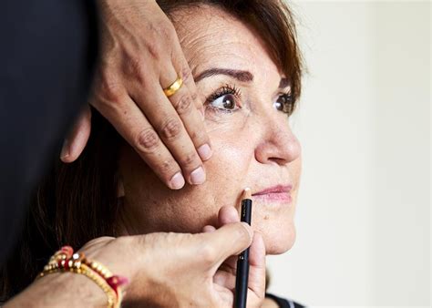 Nose To Mouth Lines Time Clinic