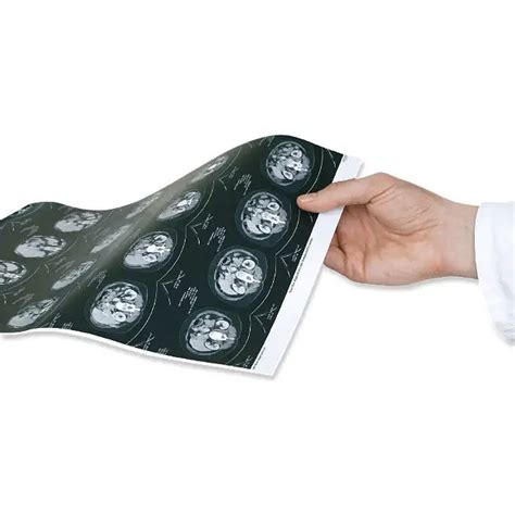 Ez Dicom Printer MPTronic