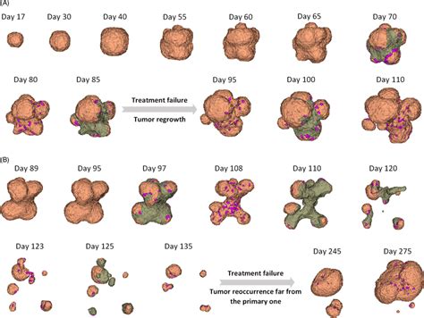 Time Evolution Of Tumor Response To Chemotherapy Indicating Treatment Download Scientific