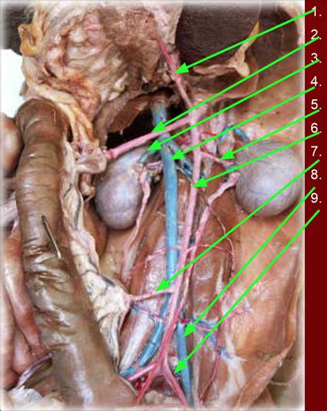 Renal Artery Cat