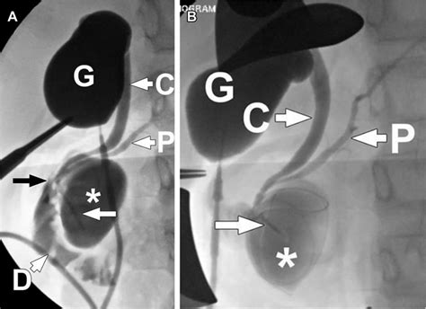 A Selected Fluoroscopic Spot Images From The Intraoperative Download Scientific Diagram