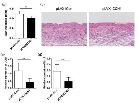 Il 23 Induced Psoriasis Model Creative Bioarray Creative Bioarray