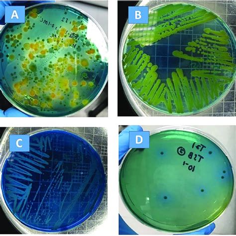 Pdf Isolation Characterization And Inactivation Of Stenotrophomonas Maltophilia From Leafy