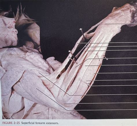 Superficial Forearm Extensors Diagram Quizlet