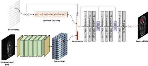 Figure 1 From Batch Implicit Neural Representation For Mri Parallel