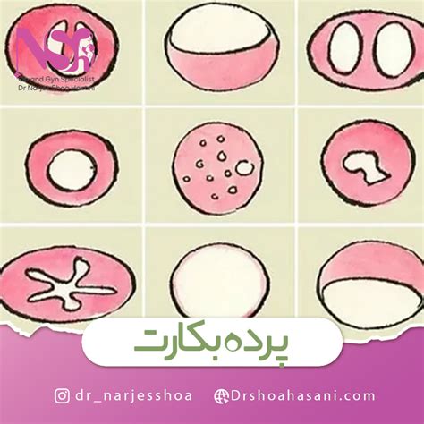 مقالات دکتر نرجس شعاع حسنی