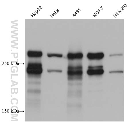 Dsp Antibody 68364 1 Ig Proteintech