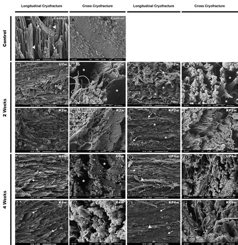 Electron Micrograph Scanning Electron Microscope Longitudinal