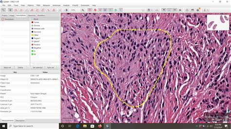 Tif Files In Qupath Not Getting Annotated Image Analysis Imagesc Forum