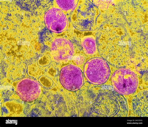 False Colour Transmission Electron Micrograph Tem Chlamydia Sp A Genus Of Small Spherical