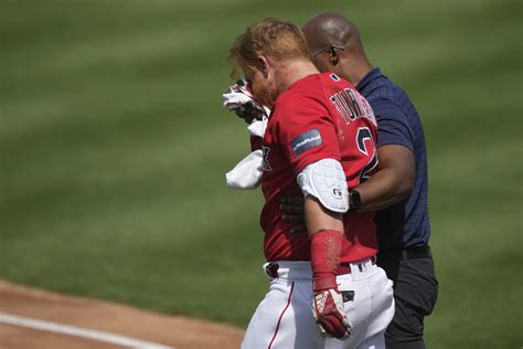 La Escalofriante Imagen De Un Jugador De Béisbol Que Sufrió Un Pelotazo
