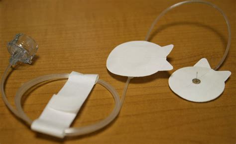 Excited About The Omnipod 5 And Dexcom G6 Closed Loop System Island