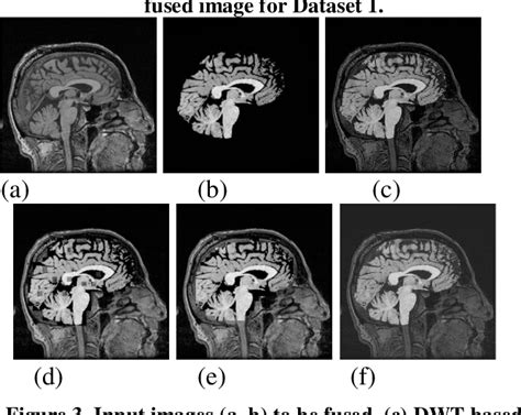 figure 1 from medical image fusion using transform based fusion