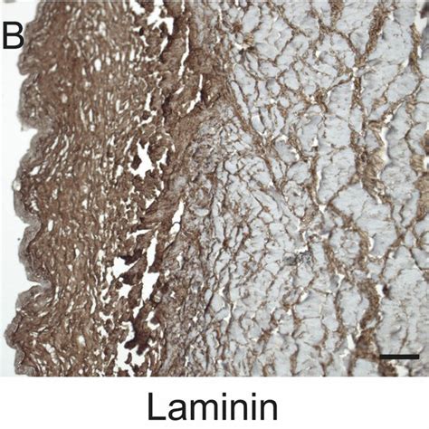Histological Characterization Of Decellularized Bovine Carotid Artery