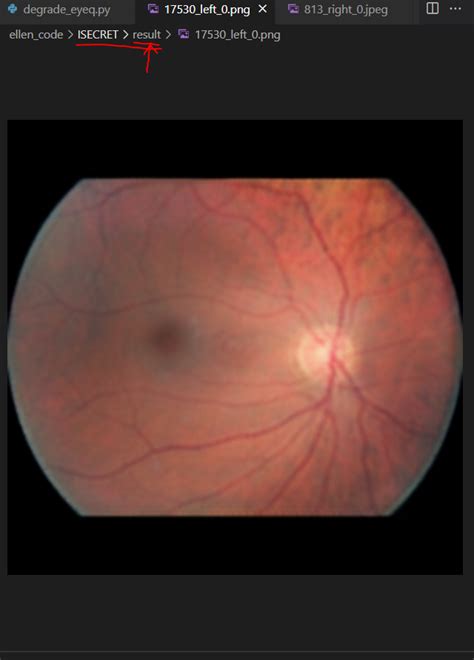 Dataset Did You Use All The Eyeq Data Issue Qtacierp Isecret Github