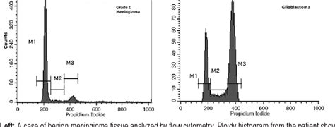 Figure 1 From Obsessive Compulsive Disorder And Cingulotomy Semantic Scholar