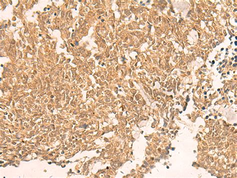 兔抗trmt112多克隆抗体anti Trmt112 Rabbit Polyclonal Antibody 生命科学产品与技术服务 生工生物