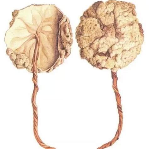 「胎盤大補，要回去真的可以吃」，產科醫生說了實情，你還吃嗎？ 壹讀