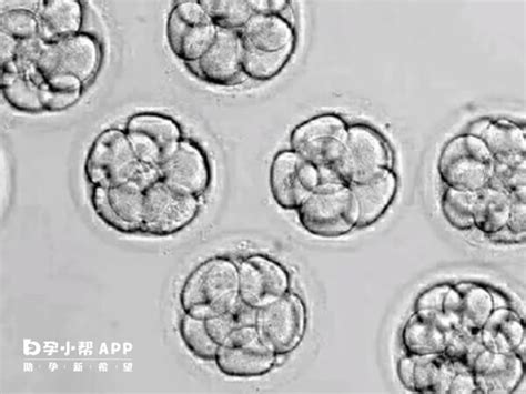 胚胎染色体异常和什么有关？与这5大因素密不可分 名医在线