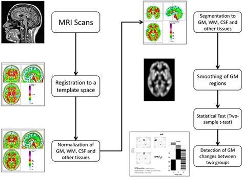 Frontiers Gray Matter White Matter And Cerebrospinal Fluid