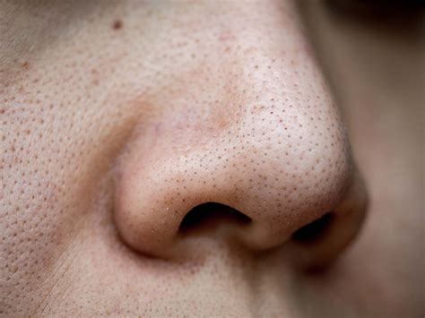29 Facts About Pores
