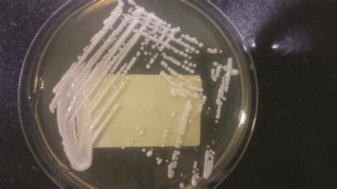 Cryptococcus Colony