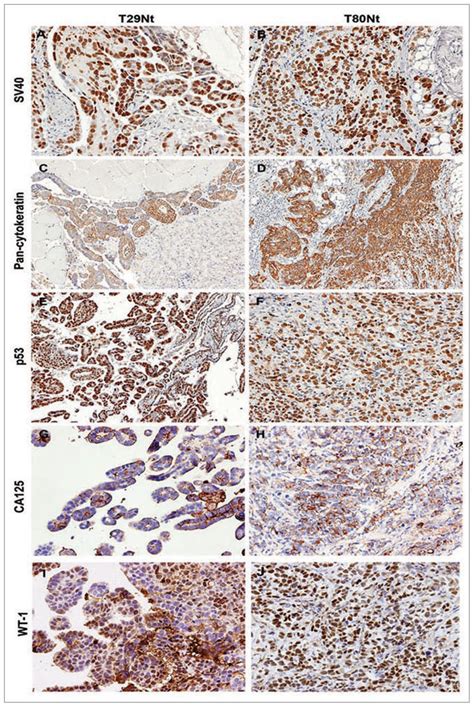 Immunohistochemical Analyses Of Tumors Immunohistochemical Staining Download Scientific