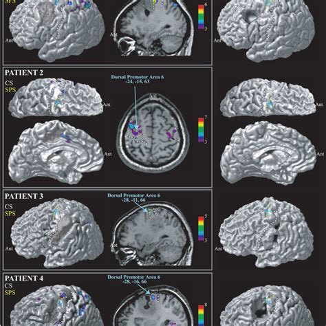 Overview Of The Neuronavigation System Used During Neurosurgery A Download Scientific Diagram
