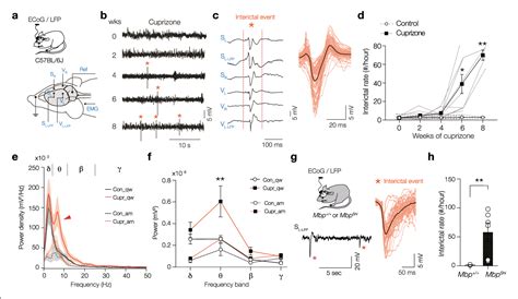 Figure 1 From Myelination Synchronizes Cortical Oscillations By Consolidating Parvalbumin