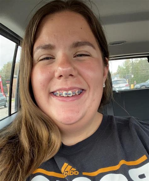 How Does One Afford Braces As An Adult R Braces