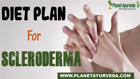 Ideal Diet Chart For Scleroderma Patients With Ayurvedic Treatment