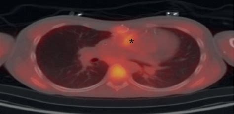 47 The Role Of Multimodality Cardiovascular Imaging Veterian Key