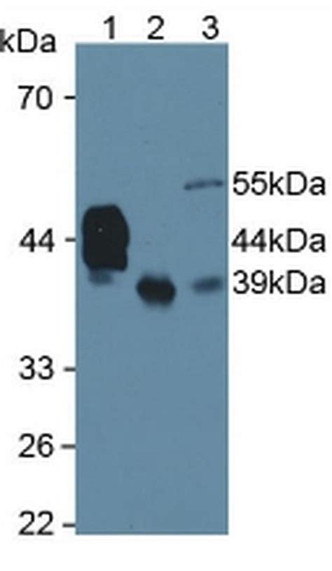 Hpr Polyclonal Antibody Pa5 121901