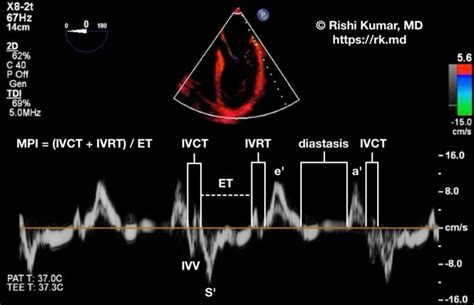 Myocardial Performance Tei Index With Doppler Tissue Imaging Dti Rk Md