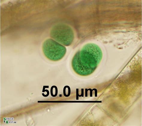 Chroococcus Subnudus Galerie