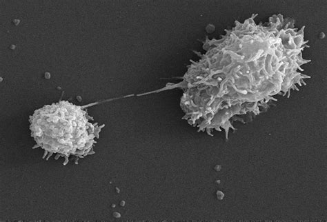 Free Picture Pseudopodia Enable Amoebae Move Grasp Objects Environment